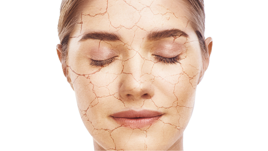 Alléger la sècheresse de la peau sèche : les soins nécessaires - PARA ...
